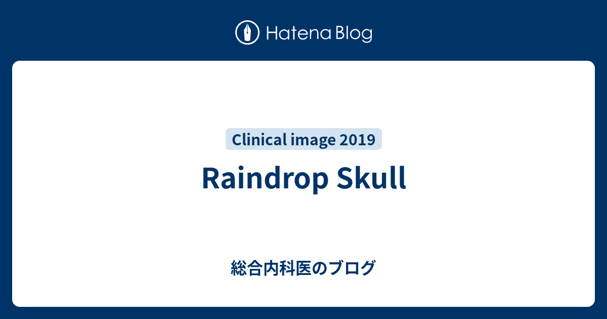 Raindrop Skull - 総合内科医のブログ
